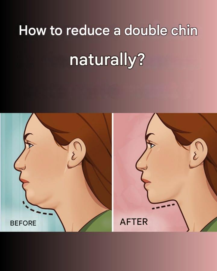 Double chin: 3 DIY steps to get rid of it without surgery – Best Recipes