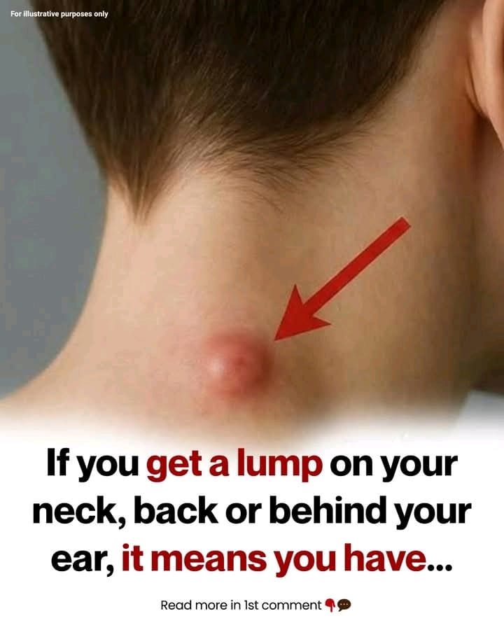If you get a lump on your neck, back or behind your ear, it means that ...